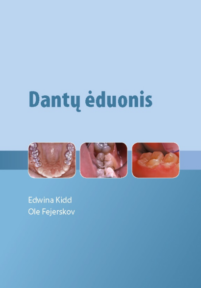 Dantų ėduonis - Vitae litera